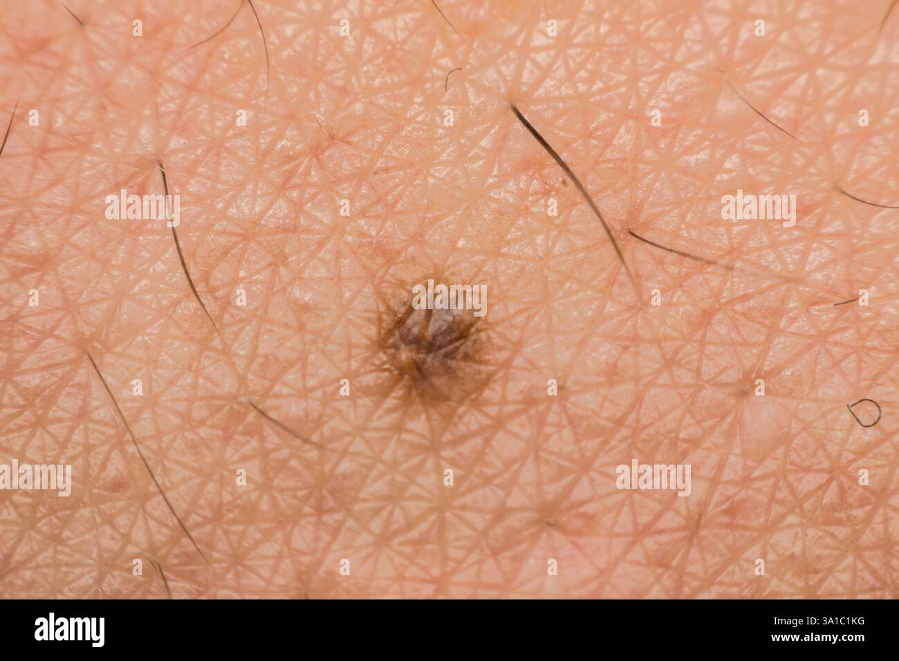 Macro of dry skin asian human with dermatology and pores on wrinkles ...