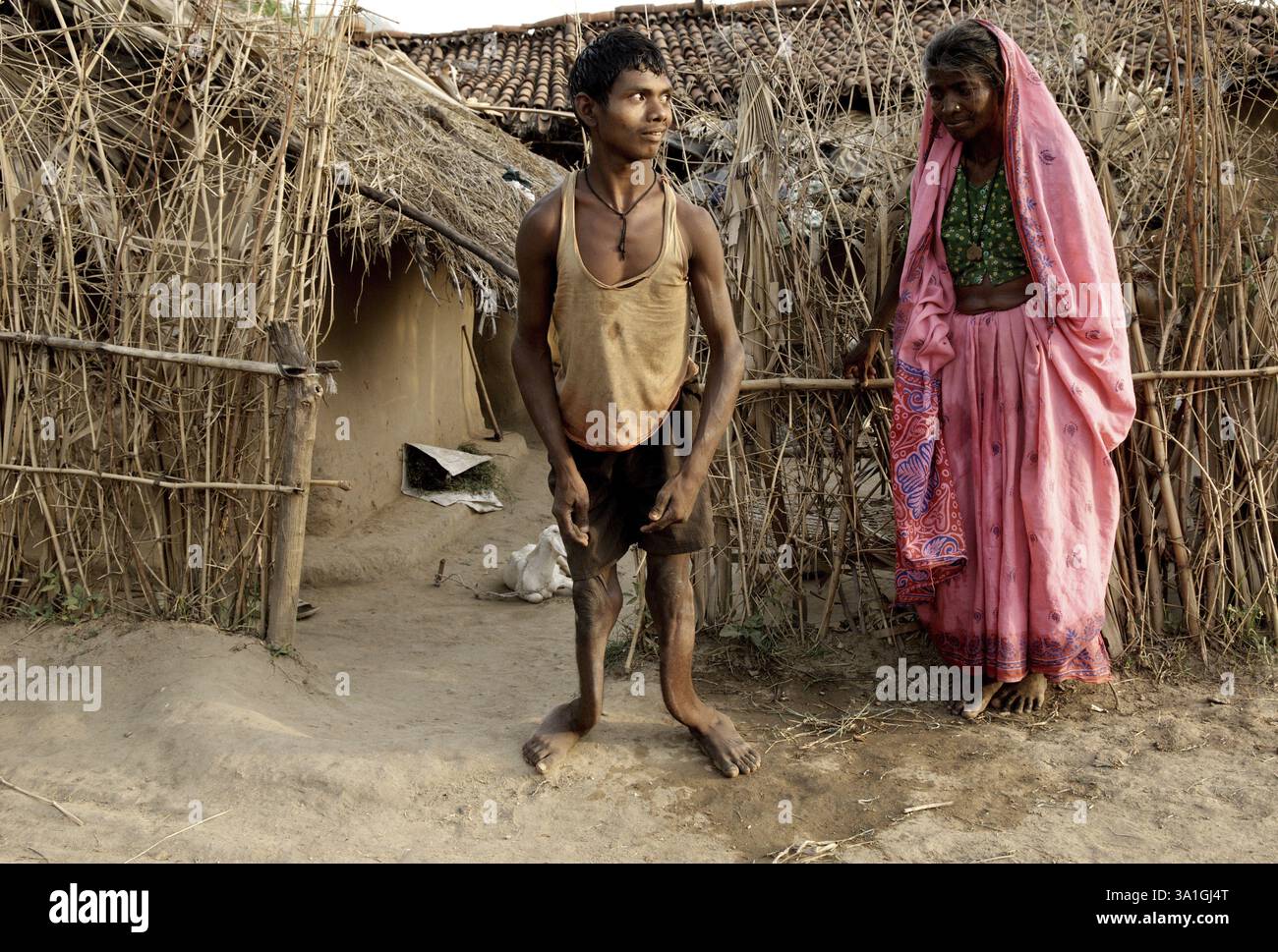 A young Handicapped boy, Garwa and Latehar, Jharkhand, India, Asia ...
