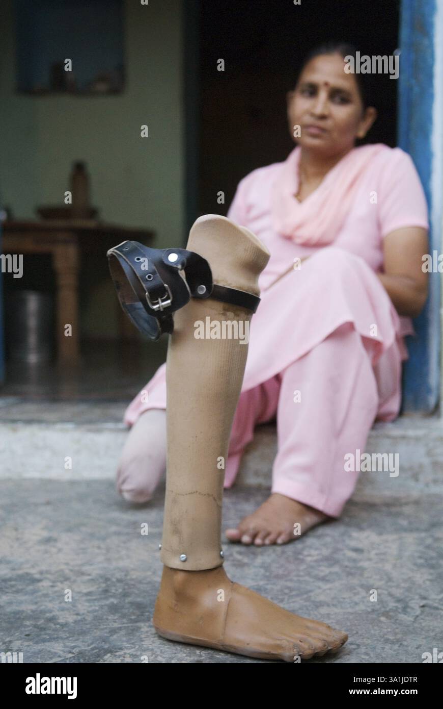 Abuse lady Anita lost her leg in accident NAw using Jaipur foot Stock ...