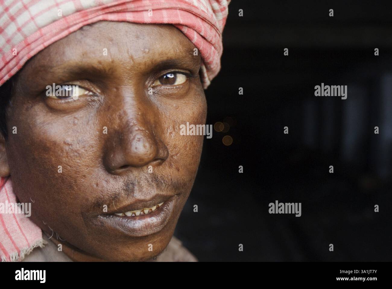 Coal miner, Coal Mines at Dhanbad, Jharkhand, India, Asia Stock Photo ...