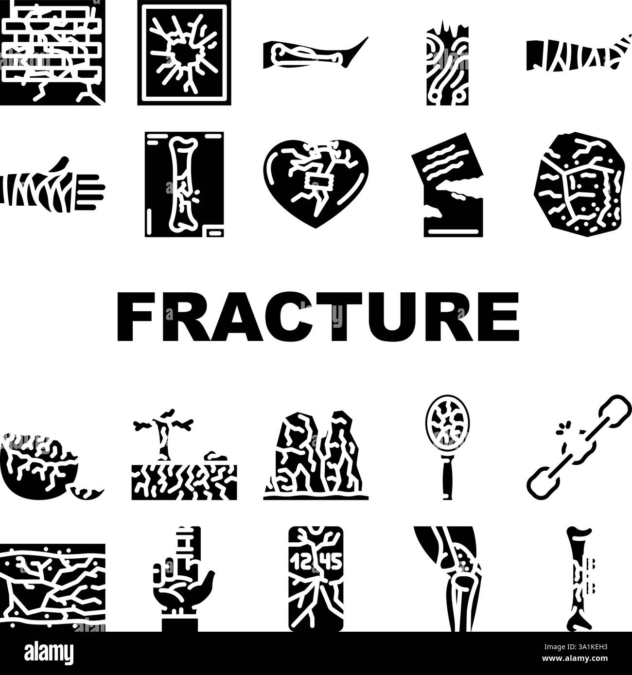 Stress fracture x ray hi-res stock photography and images - Alamy