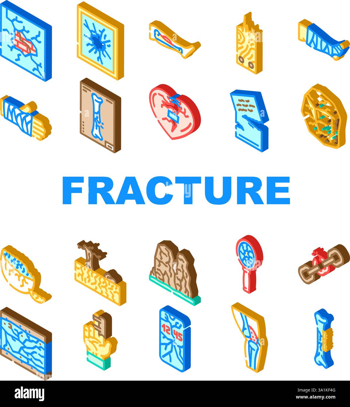 Stress fracture x ray hi-res stock photography and images - Alamy