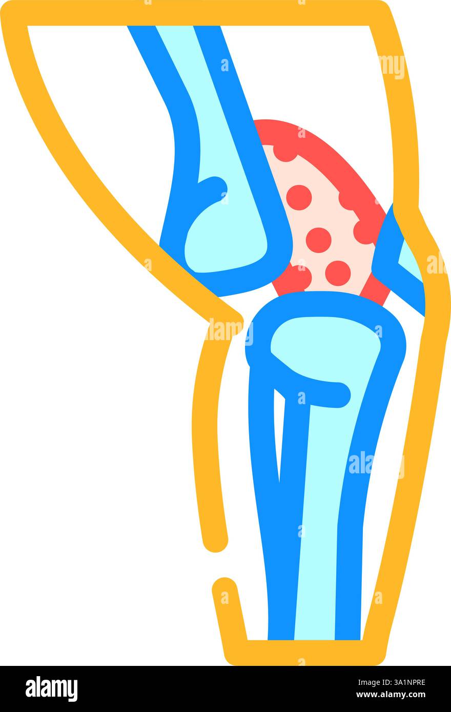 dislocated joint fracture color icon vector illustration Stock Vector ...