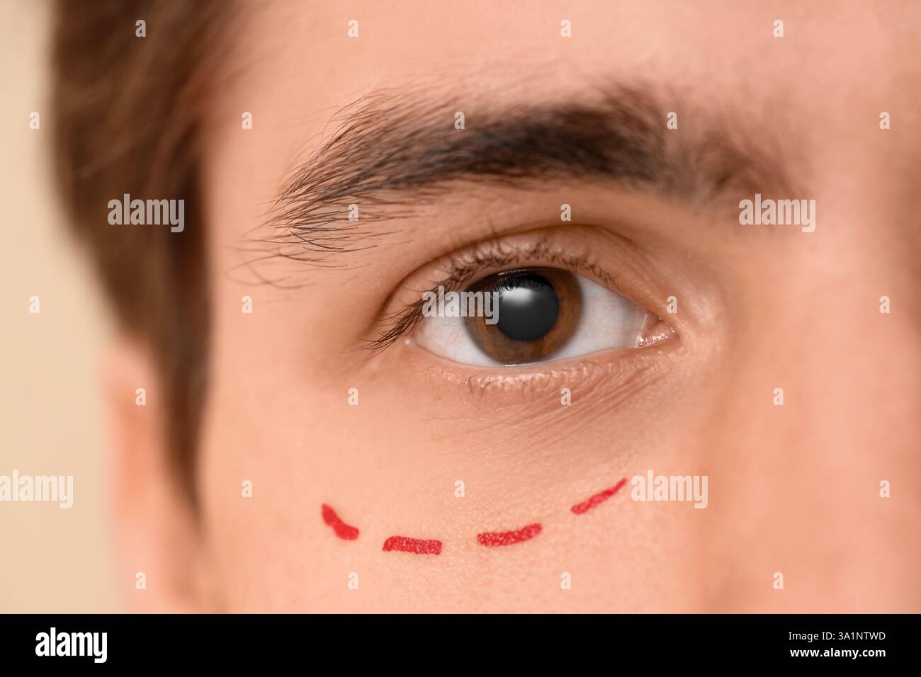 Young man with marked face on beige background, closeup. Plastic ...