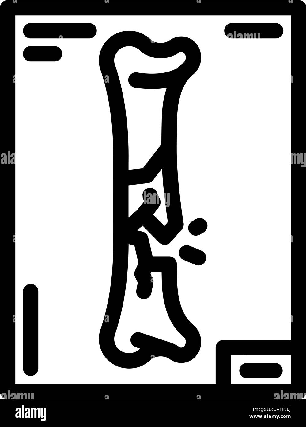 x ray of fracture line icon vector illustration Stock Vector Image ...
