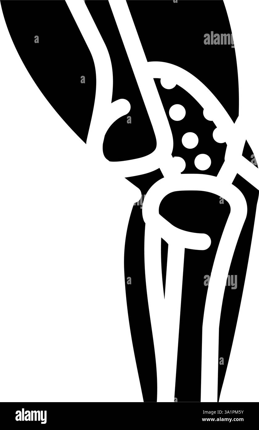 dislocated joint fracture glyph icon vector illustration Stock Vector ...