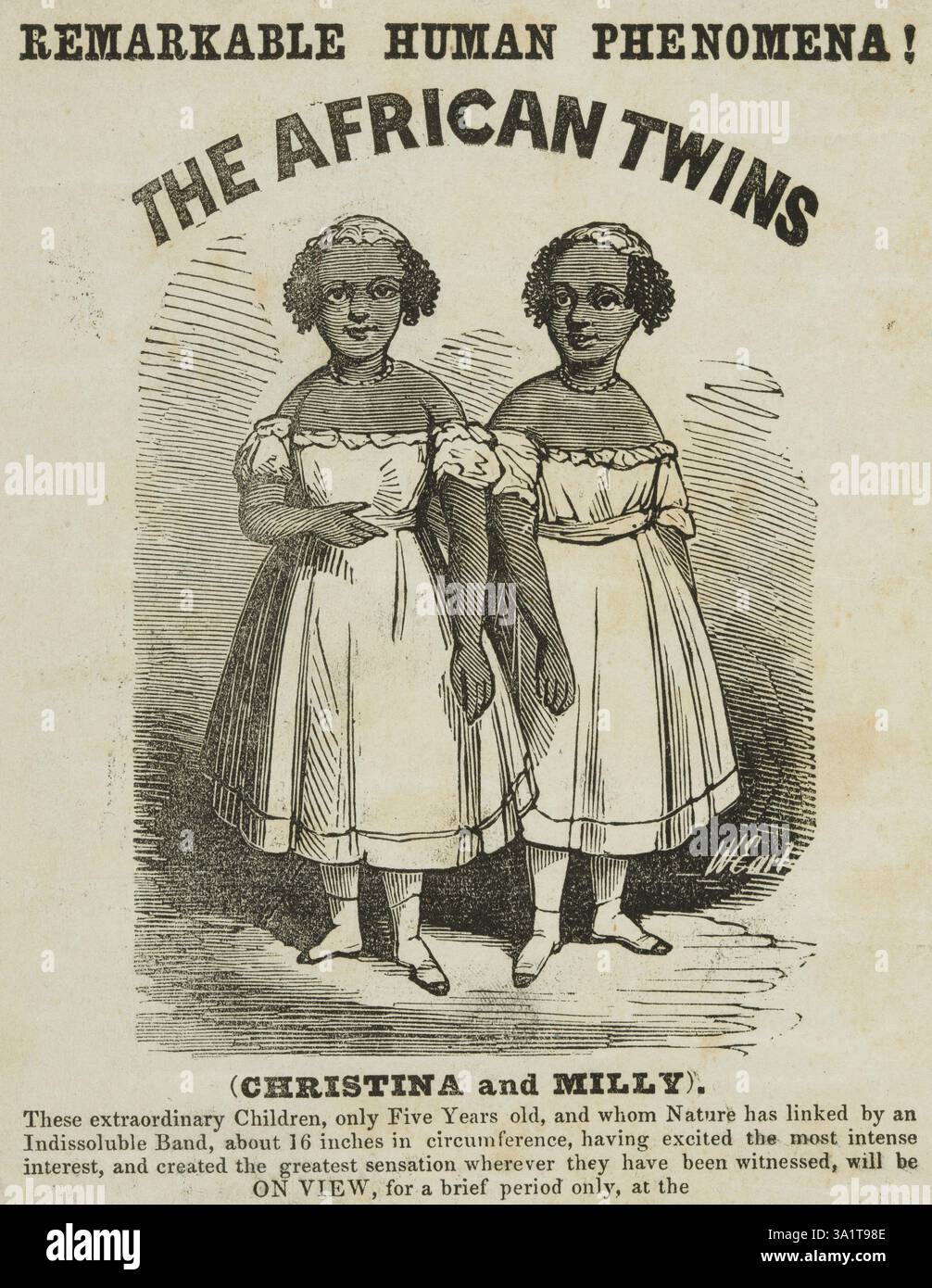 The African Twins, 1855. 'Remarkable Human Phenomena! (Christina and ...