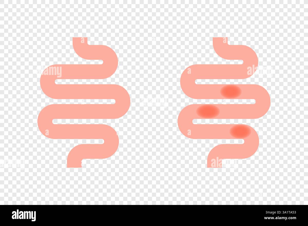 Intestines and bowel ache. Colitis vector icon Stock Vector Image & Art ...
