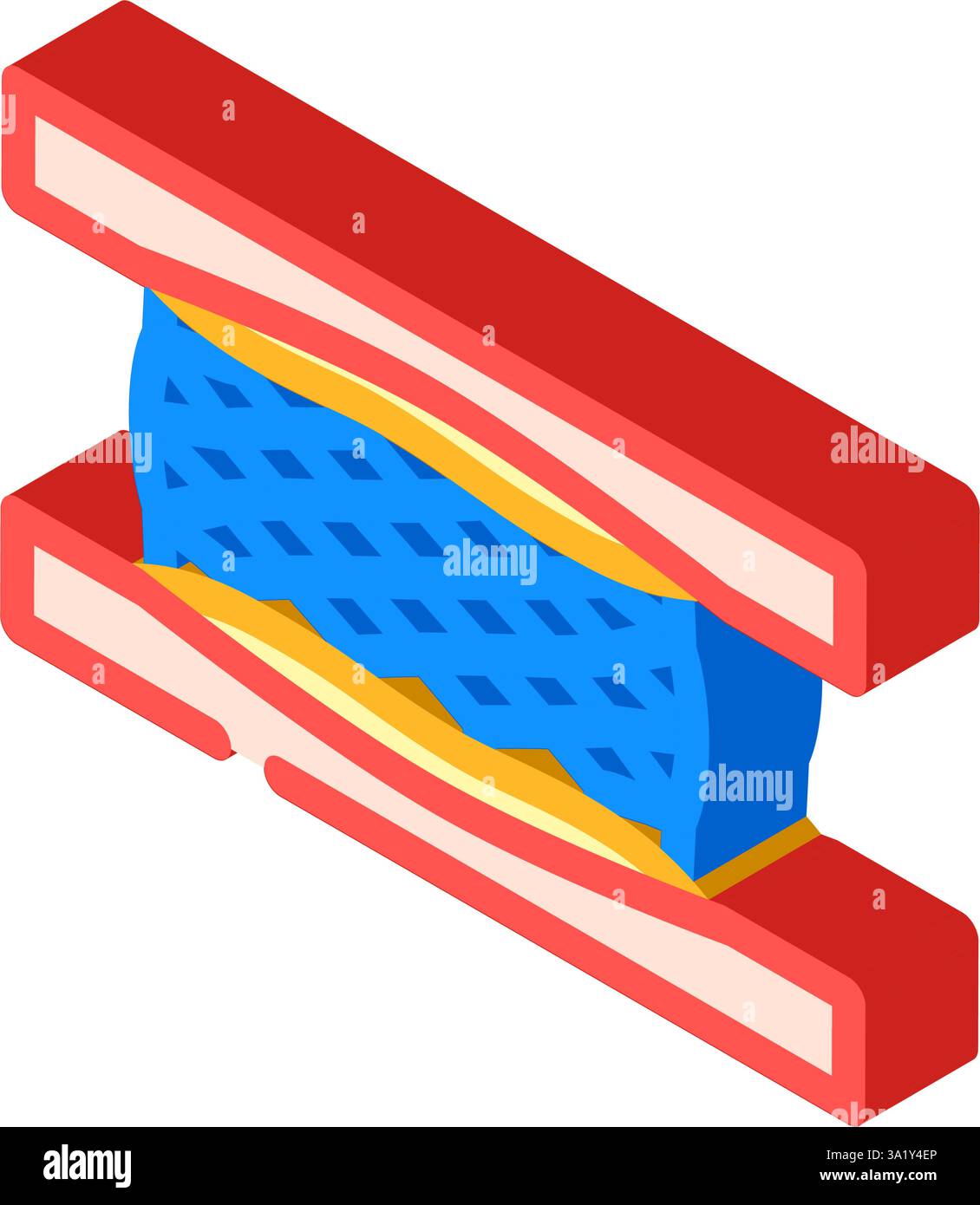 coronary stent cardiology isometric icon vector illustration Stock ...
