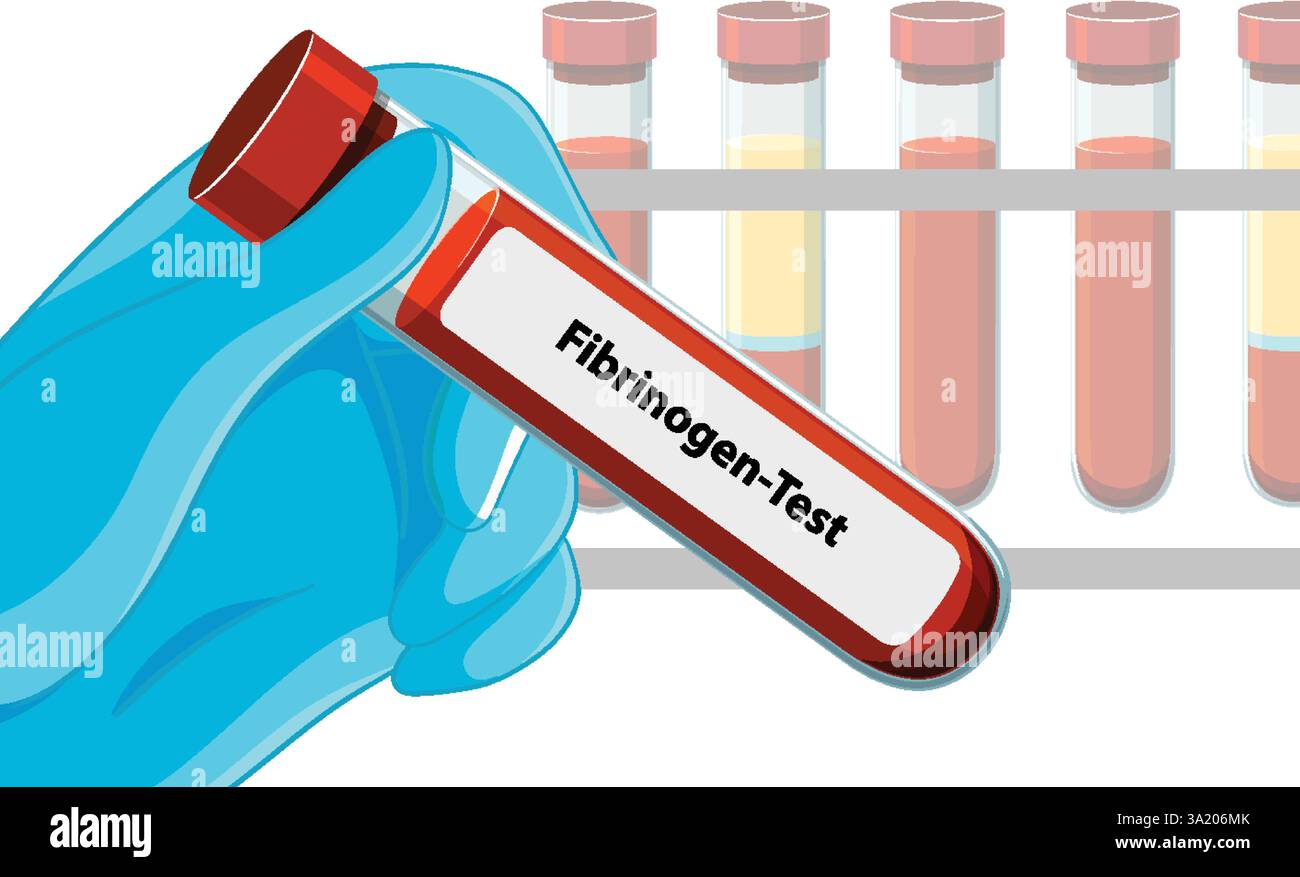 Fibrinogen hi-res stock photography and images - Alamy