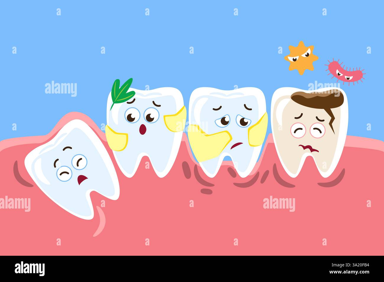 Periodontal disease . Dental caries, dental plaque, wisdom tooth and ...
