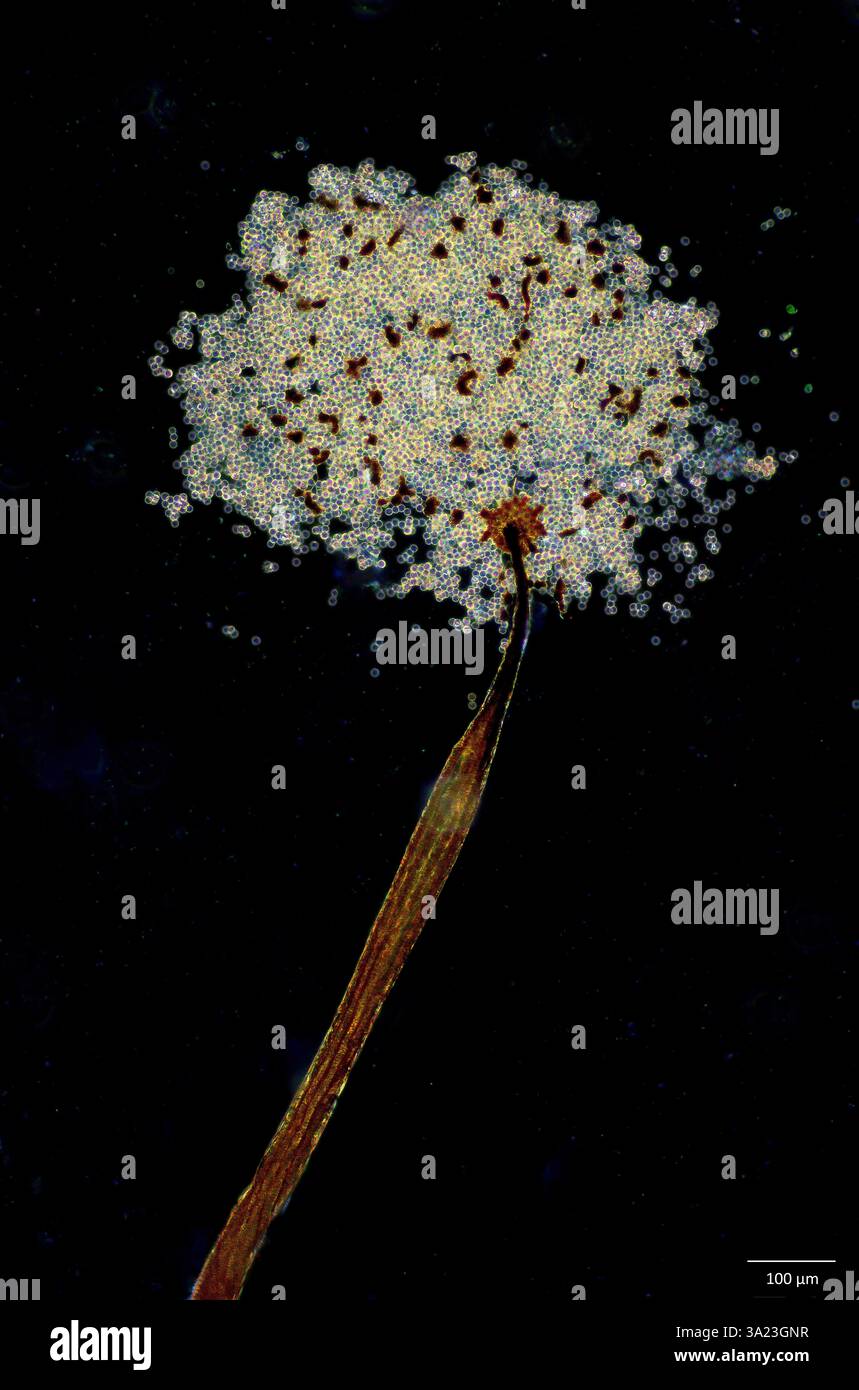 Micro photo of the sporotheca (fruiting body) with spores and ...