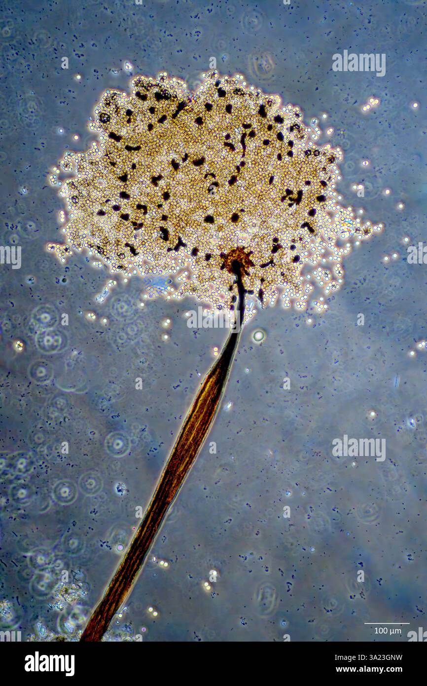 Micro photo of the sporotheca (fruiting body) with spores and ...