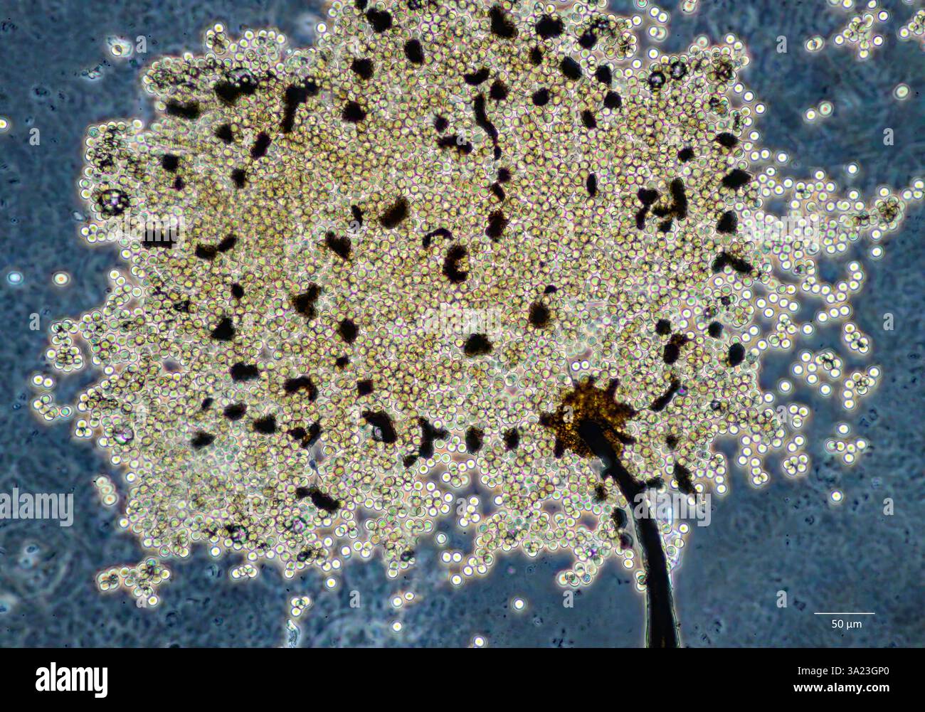 Micro photo of the sporotheca (fruiting body) with spores and ...