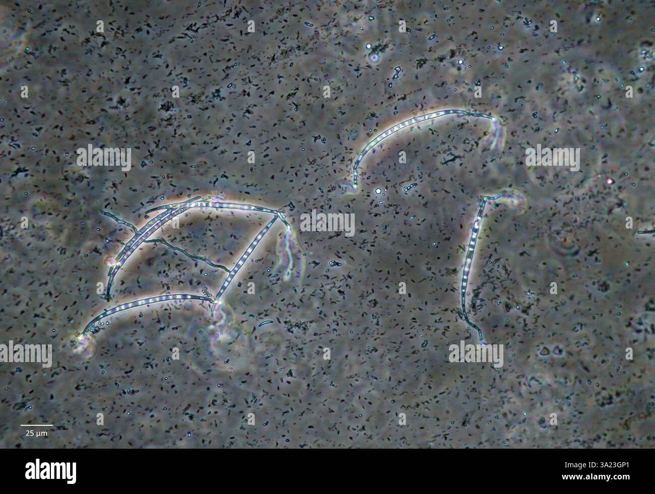 Macroconidia (microscopic asexual spores) produced by the fungus ...