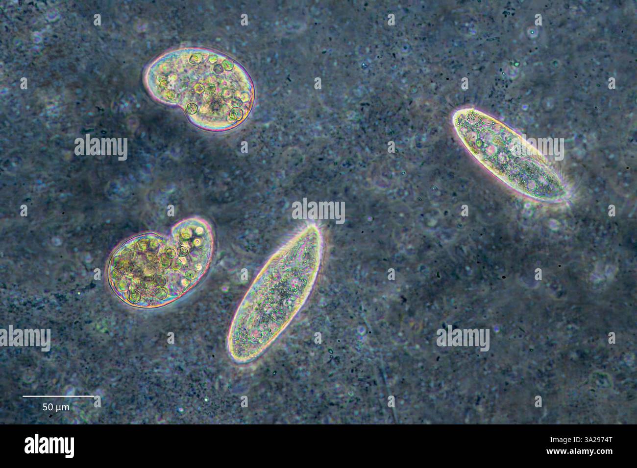 Two species of Ciliated protozoans probably from the subclass ...