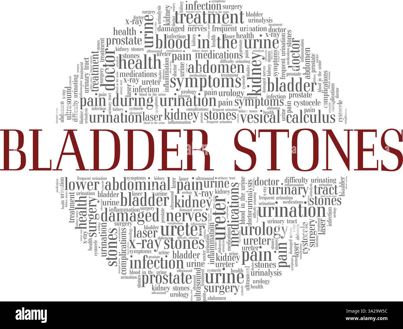 Bladder Stones vector illustration word cloud isolated on a white ...