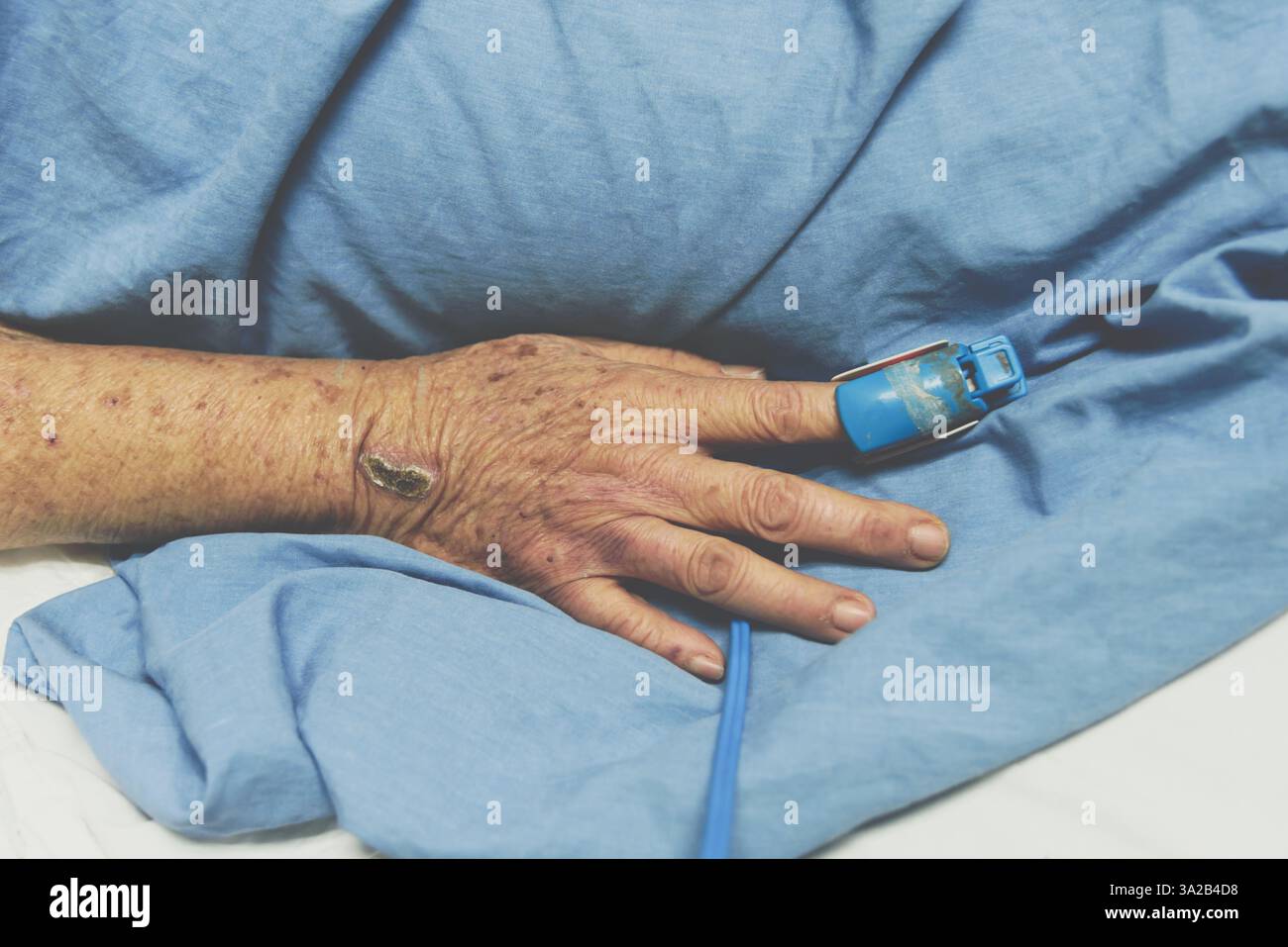 Patient in the hospital with pulse gauge for heartbeat measuring and ...