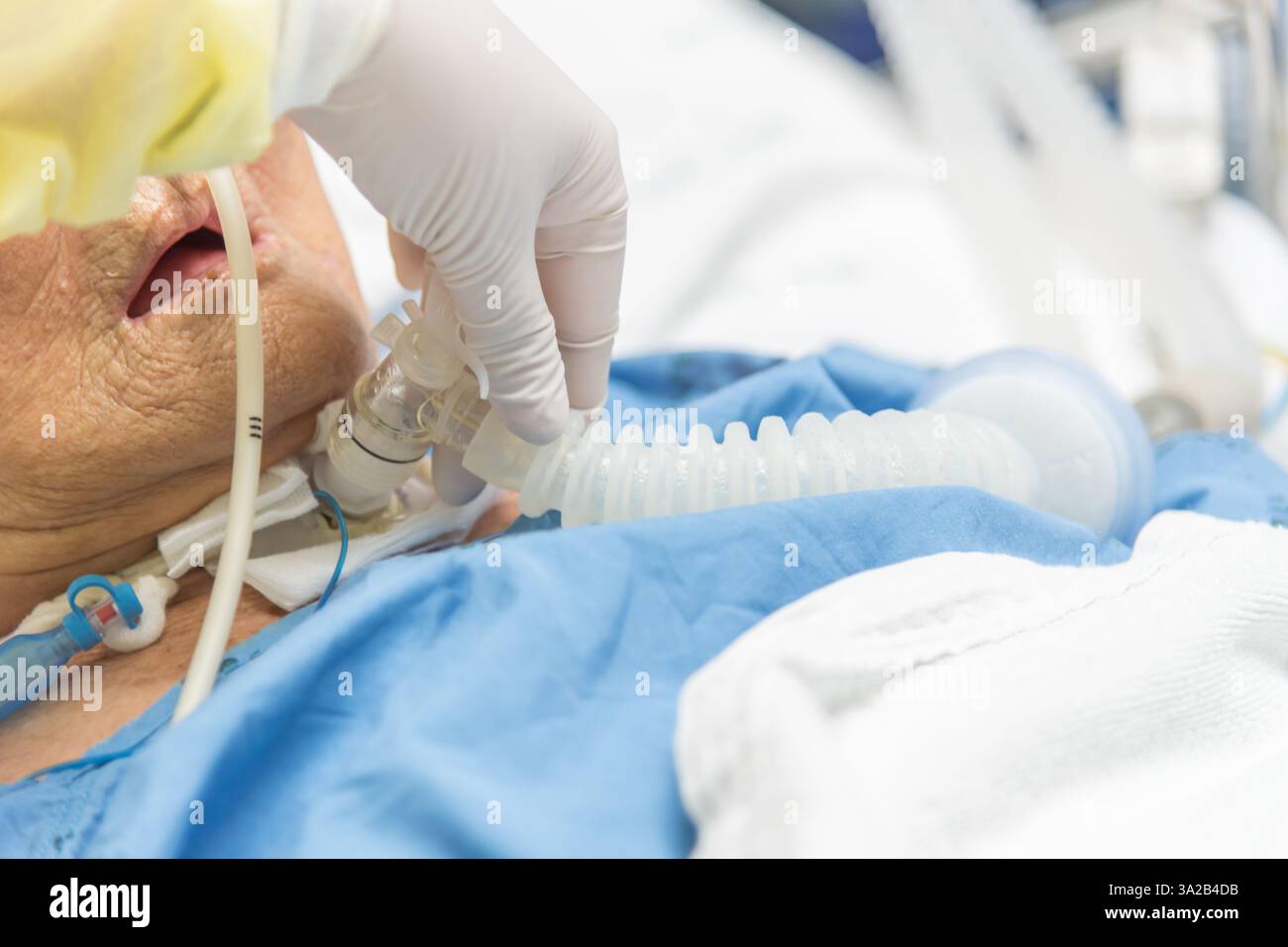 Patient asian elder women 80s do tracheostomy use ventilator for ...
