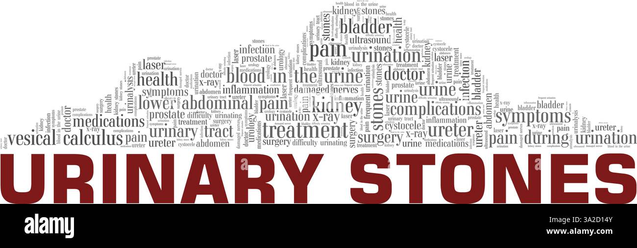 Urinary Stones vector illustration word cloud isolated on a white ...