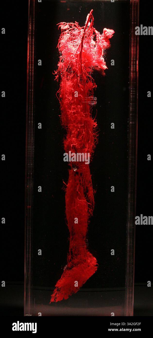 Nov 19, 2005; New York, NY, USA; A view of the nervous system of a leg ...