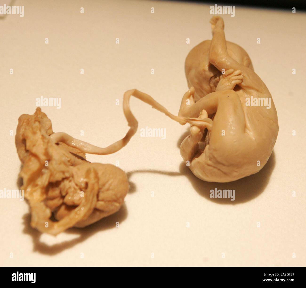 Human Fetus
