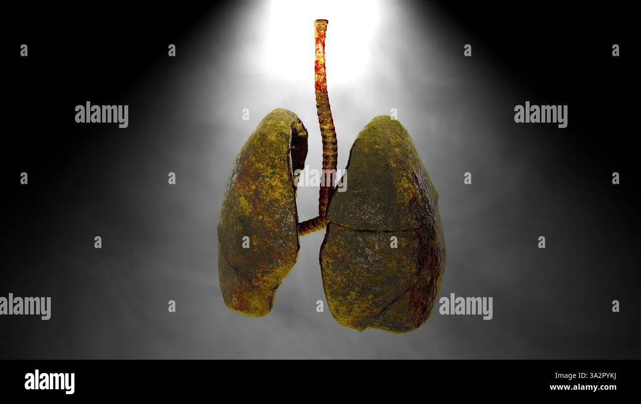 Smoker Human lungs. Computer generated 3d render Stock Photo - Alamy