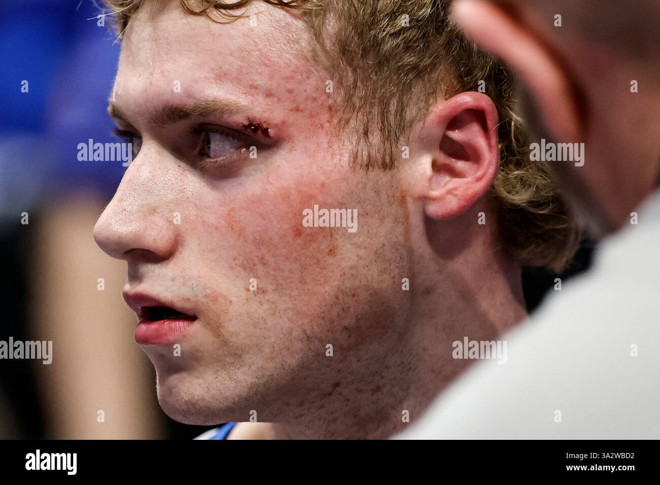 Kentucky guard Collin Chandler (5) heads to the bench after injury ...