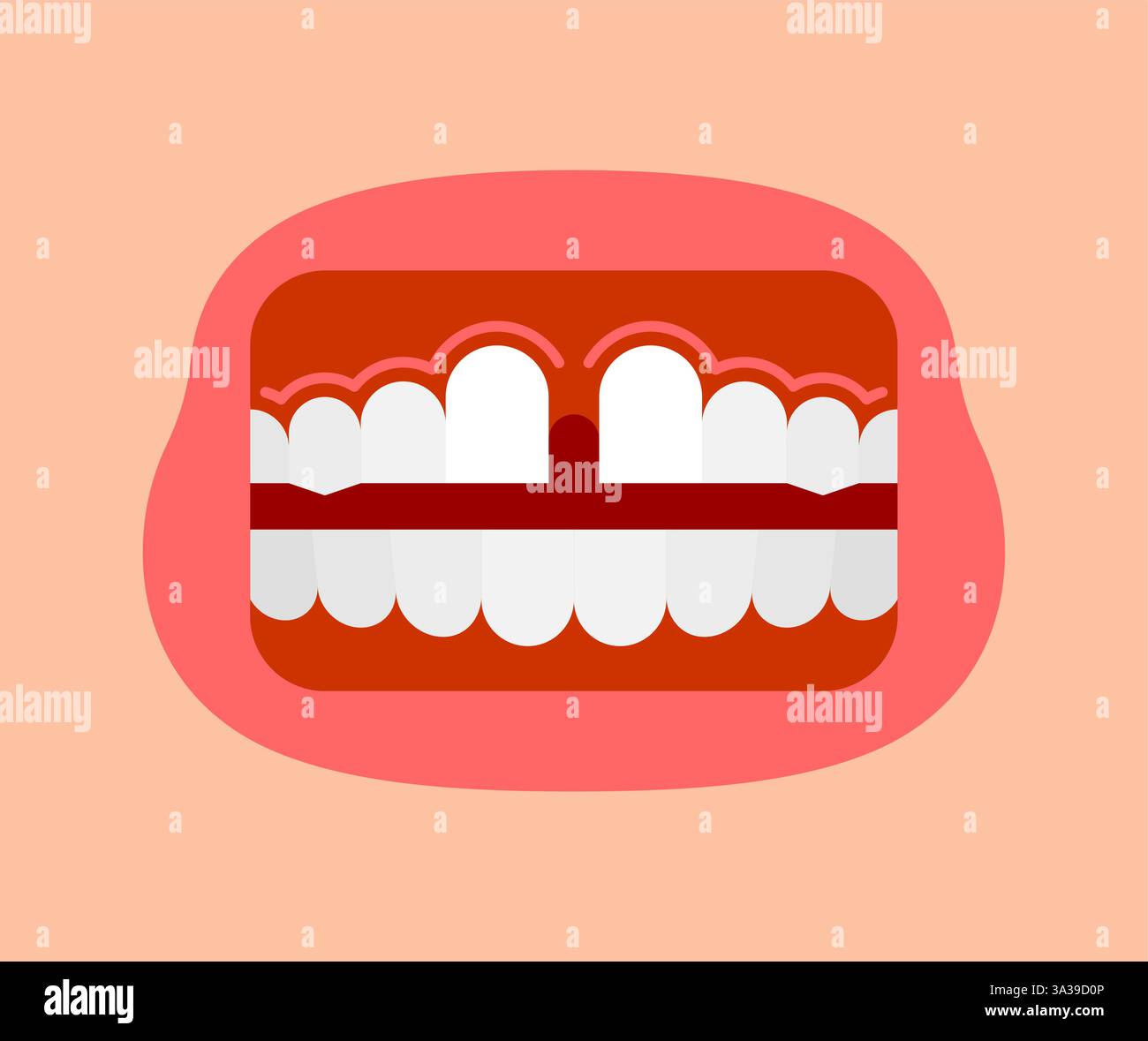 Gap mouth. Large space between teeth Stock Vector Image & Art - Alamy