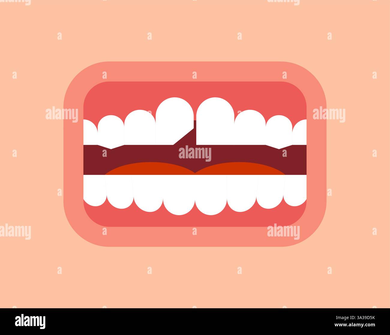 Chipped tooth in mouth. Broken tooth Stock Vector Image & Art - Alamy
