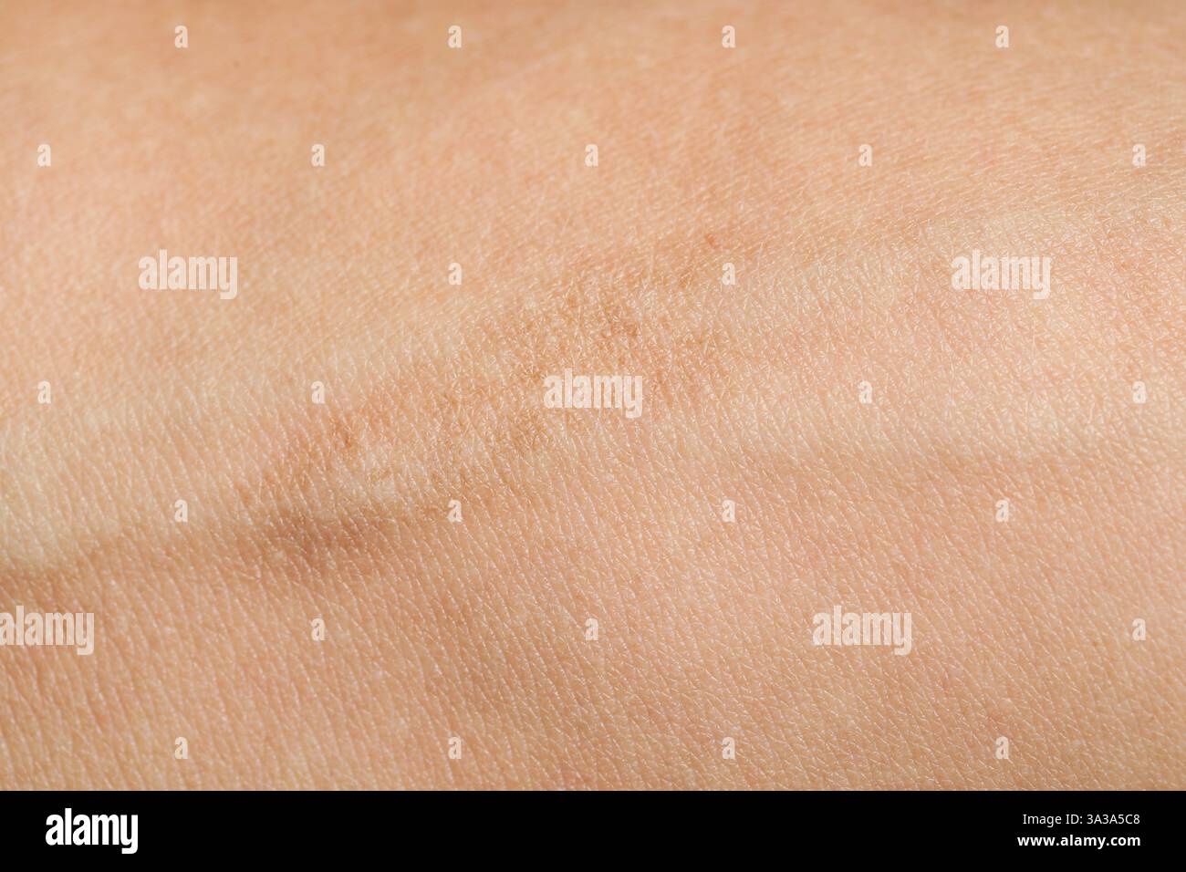 Texture of skin with scar as background, closeup Stock Photo - Alamy
