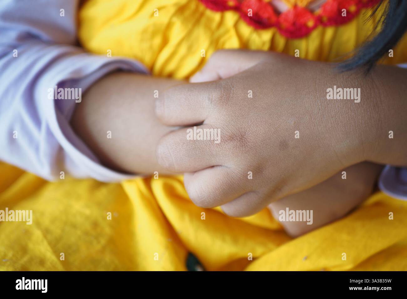 child hand suffering itching skin Stock Photo - Alamy