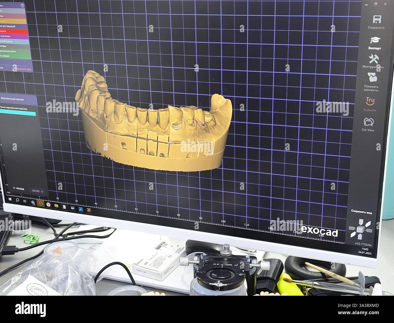 Dental cad software displaying 3d model of human jaw on screen in ...