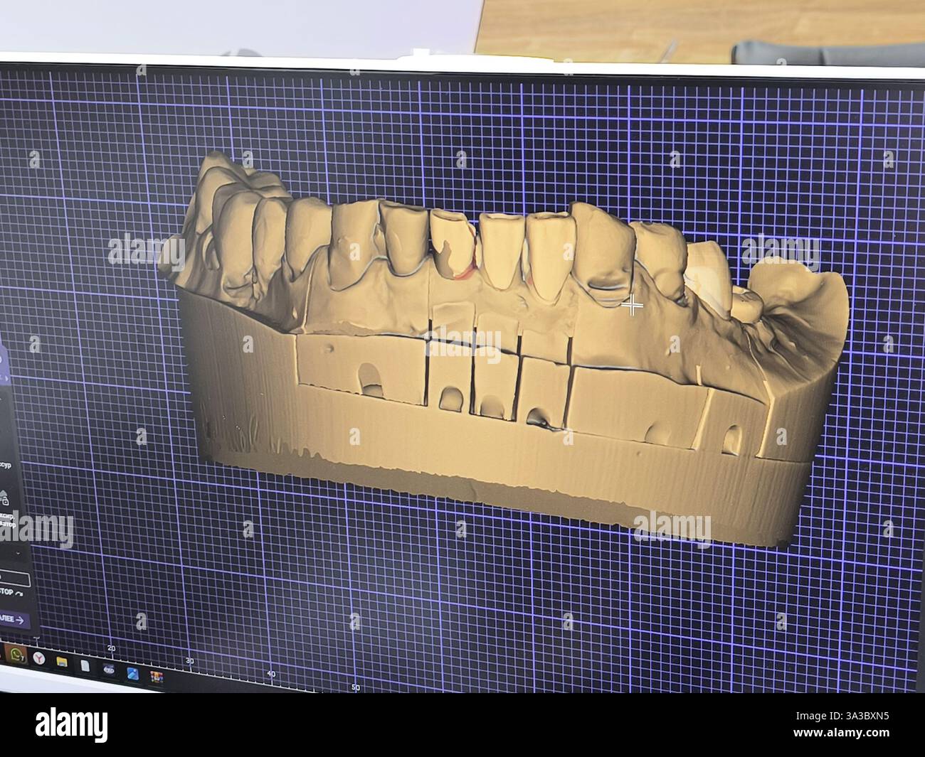 Detailed dental anatomy model hi-res stock photography and images - Alamy