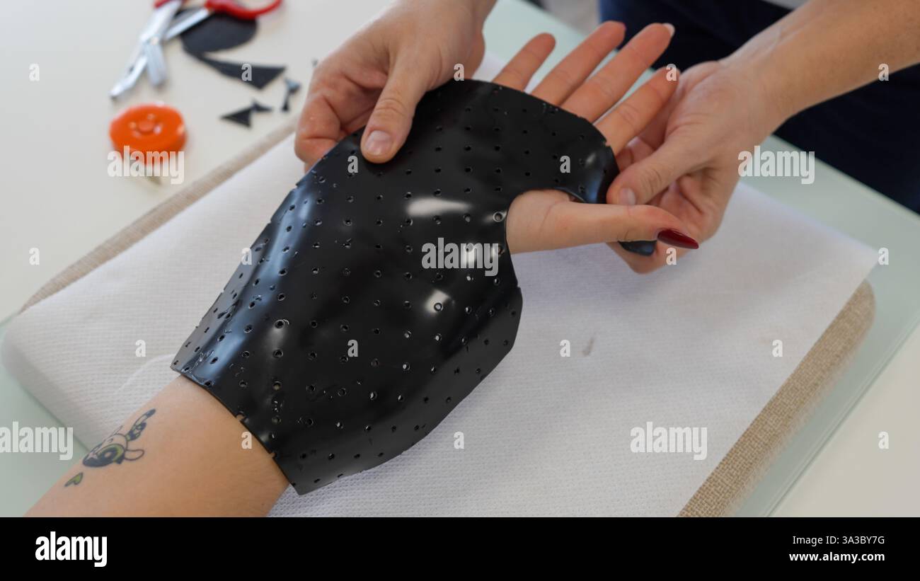 Close-up of a physiotherapist fitting a custom hand support for a ...