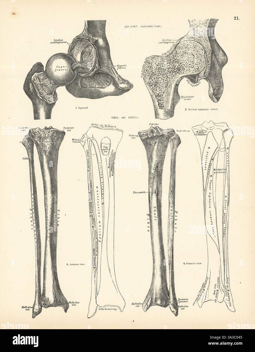 Anatomy. Hip Joint, Tibia, Fibula 1880 old antique vintage print ...
