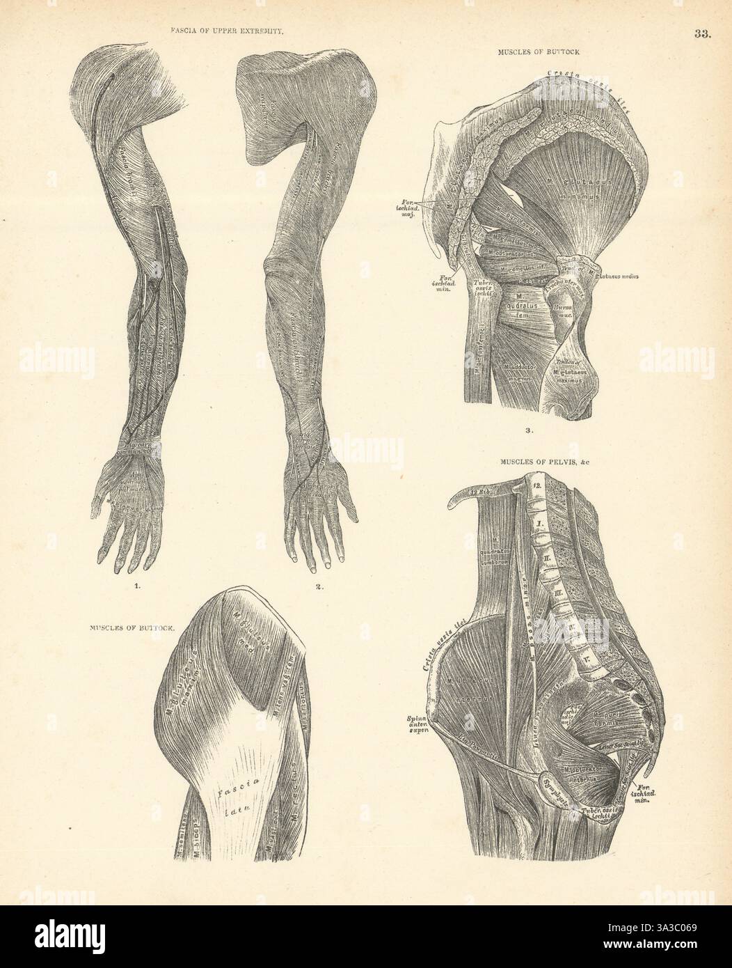 Anatomy. Fascia of Upper Extremity, Buttock, Pelvis Muscles 1880 old ...