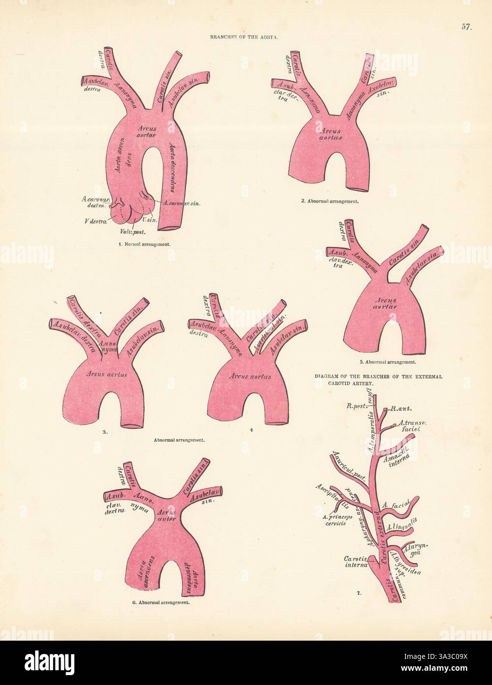 Anatomy. Aorta Branches, External Carotid Artery Diagram 1880 old print ...