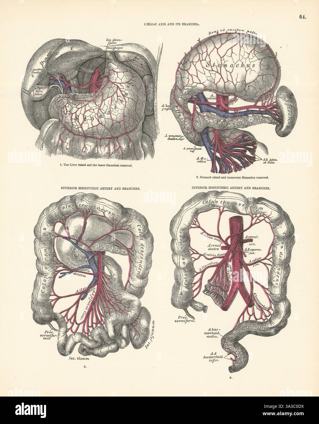 Anatomy. Coeliac Axis & Branches, Superior & Inferior Mesenteric ...