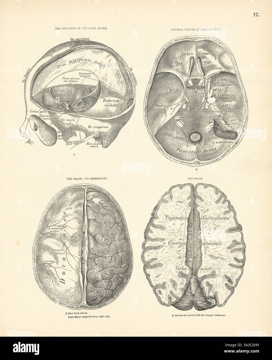 Anatomy. Processes of Dura Mater, Cranial Nerves, Brain & Membranes ...