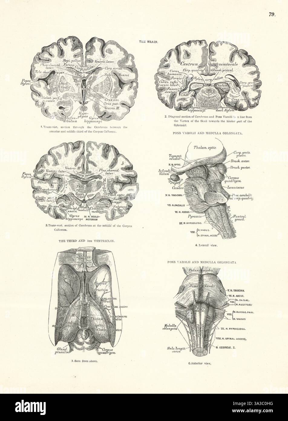 Anatomy. Brain, Pons Varolii, Medulla Oblongata, 3rd & 5th Ventricles ...