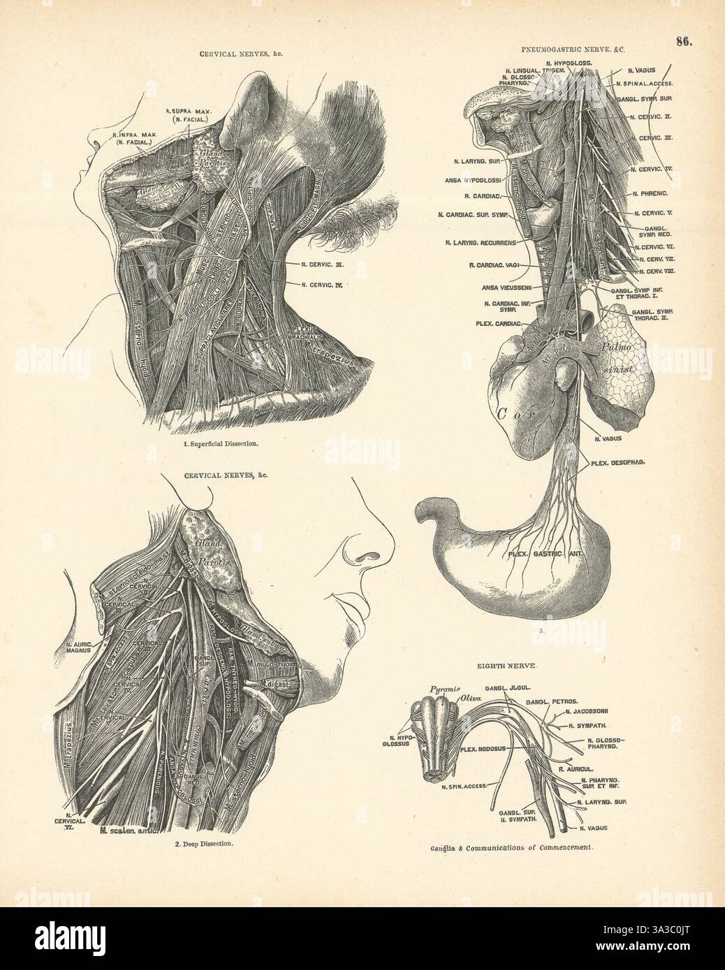 Anatomy. Cervical & Pneumogastric Nerves, Eighth Nerve 1880 old antique ...