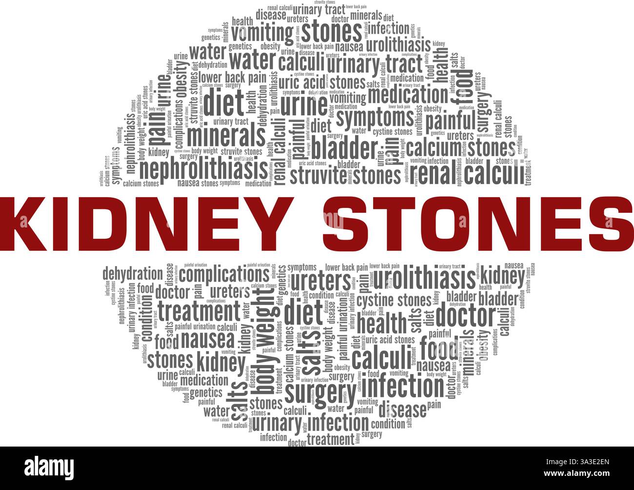 Kidney Stones vector illustration word cloud isolated on a white ...