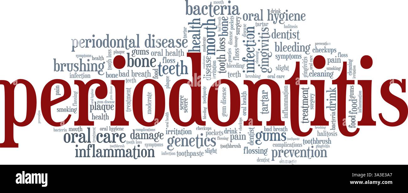 Periodontitis - Periodontal Disease vector illustration word cloud ...