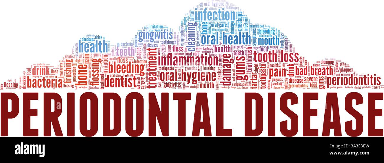 Periodontitis - Periodontal Disease vector illustration word cloud ...