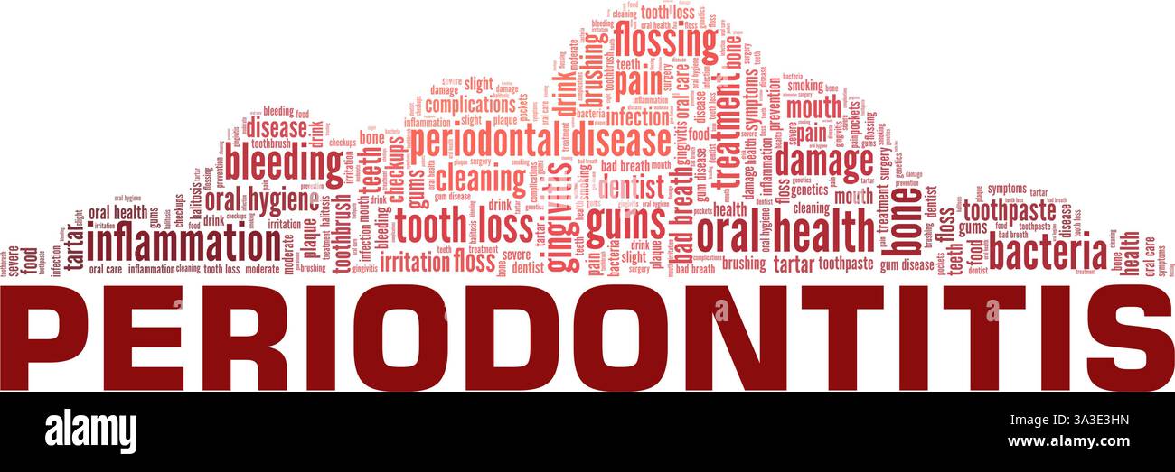 Periodontitis - Periodontal Disease vector illustration word cloud ...