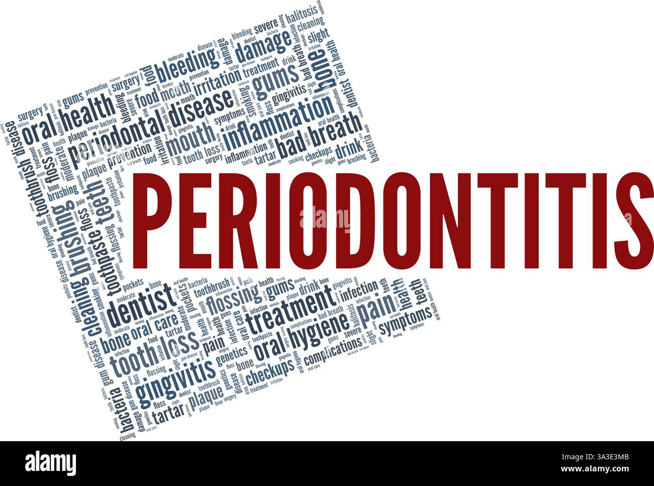 Periodontitis - Periodontal Disease vector illustration word cloud ...