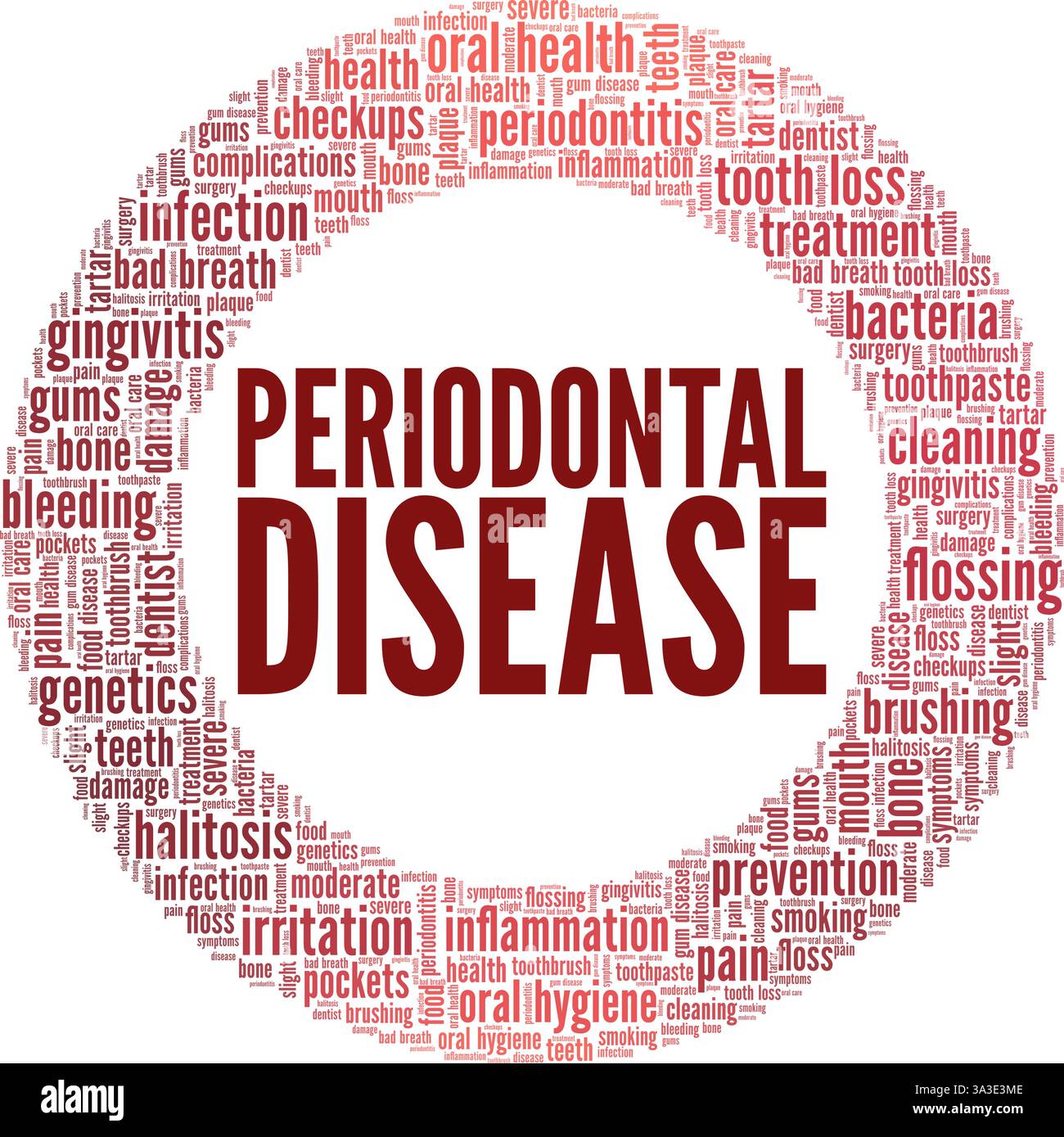 Periodontitis - Periodontal Disease vector illustration word cloud ...