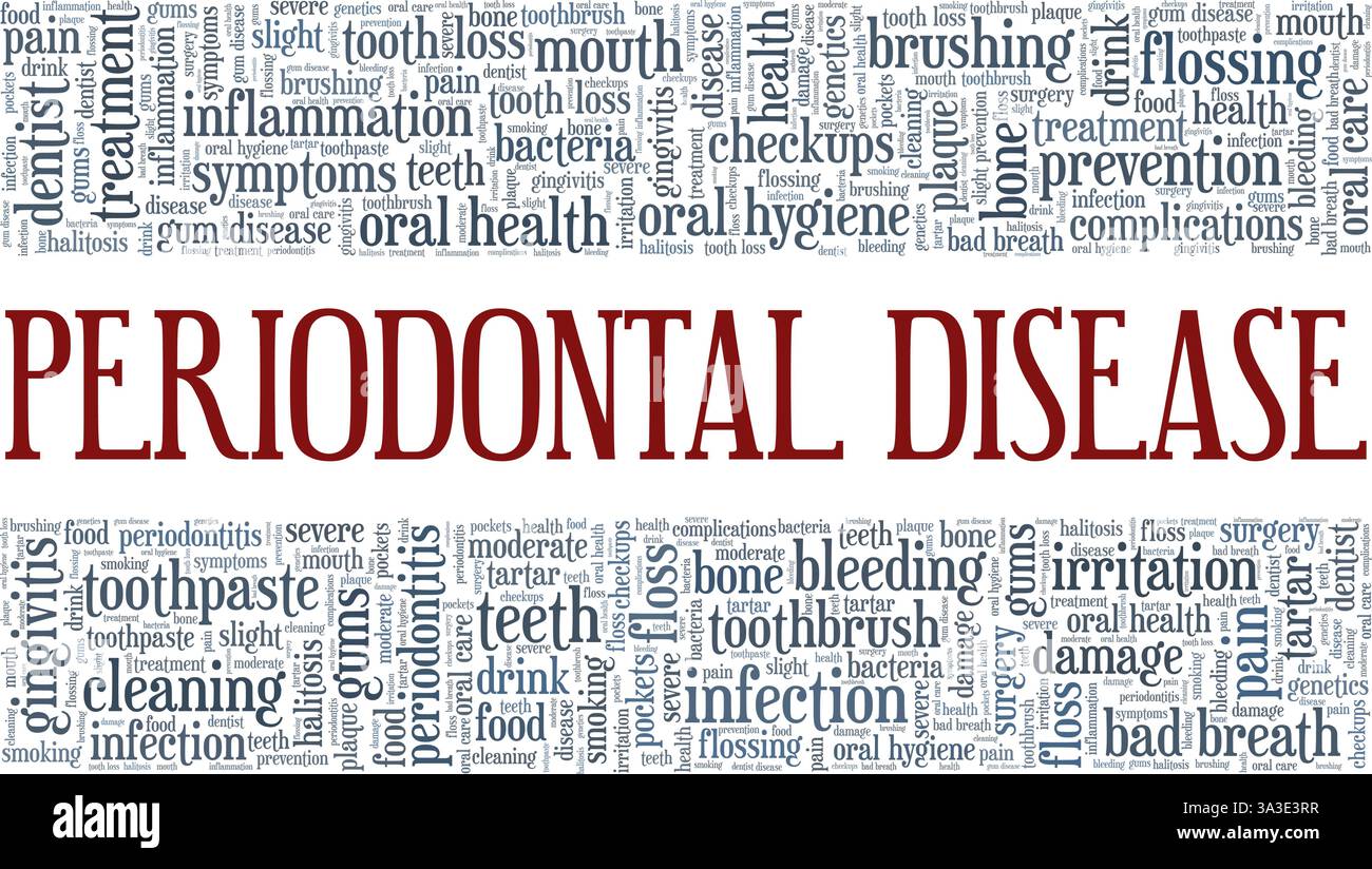 Periodontitis - Periodontal Disease vector illustration word cloud ...