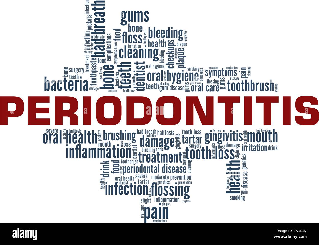 Periodontitis - Periodontal Disease vector illustration word cloud ...
